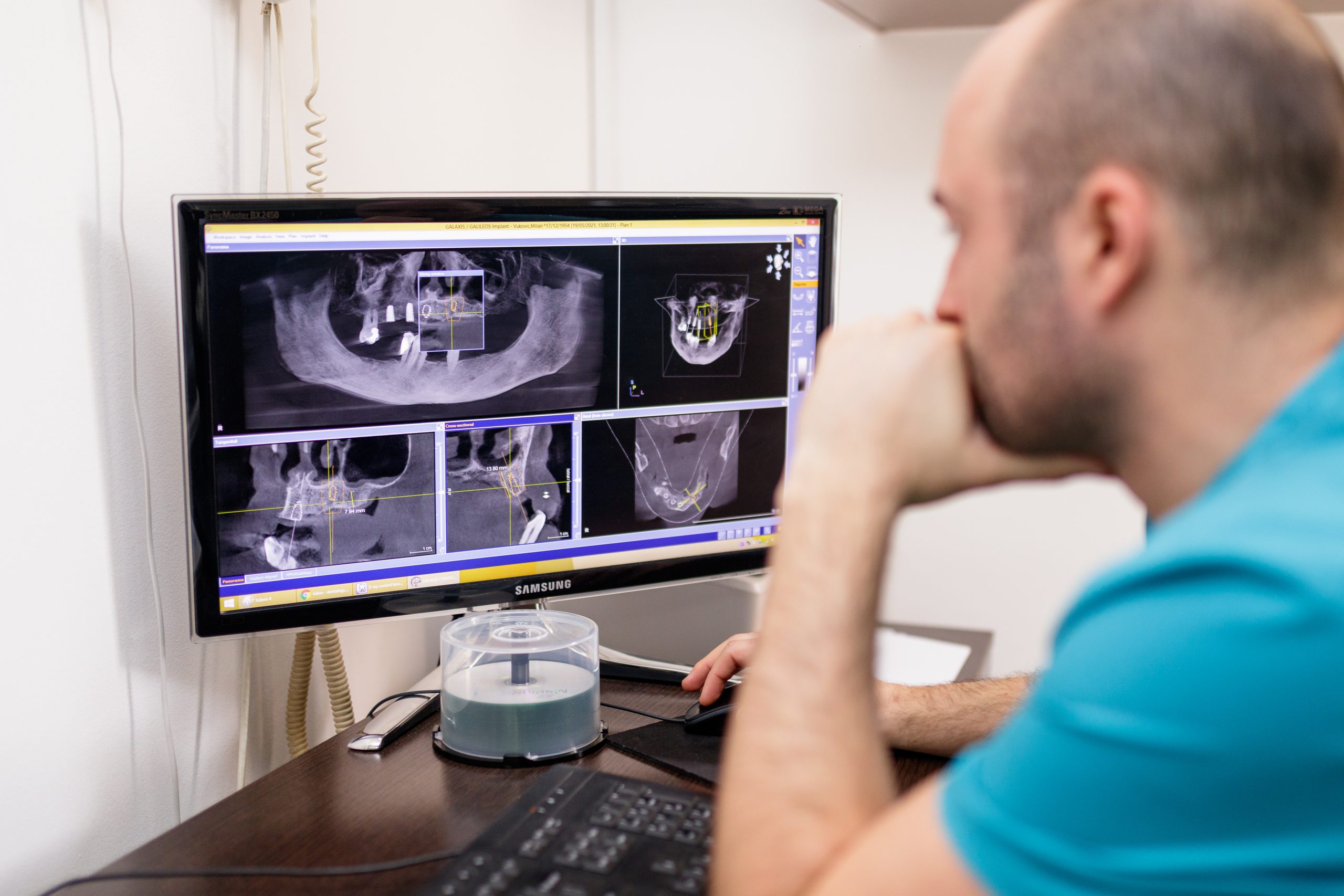 Dental RTG centar | Usluge