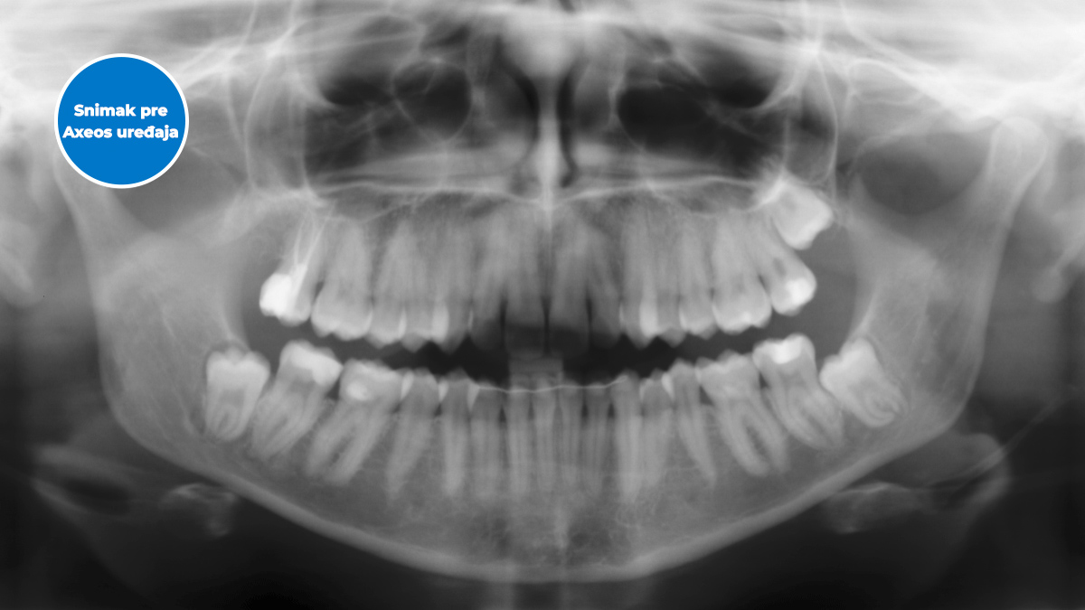 Axeos CBCT - Doživite razliku - Dental RTG centar